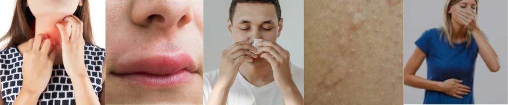 Taro Root Allergies: Here's What You Need to Know - ToAgriculture